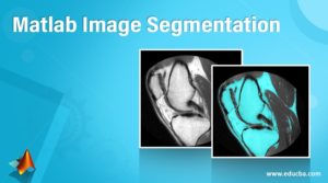 Matlab Image Segmentation | How does Image Segmentation work?