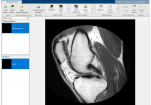 Matlab Image Segmentation | How does Image Segmentation work?