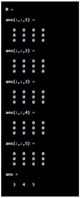 Matlab Zeros Complete Guide To The Matlab Zeros
