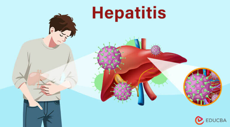 What is Hepatitis? Causes, Symptoms and Health Impact