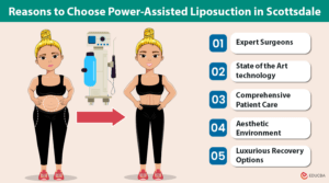 Power-Assisted Liposuction in Scottsdale |A Complete Guide